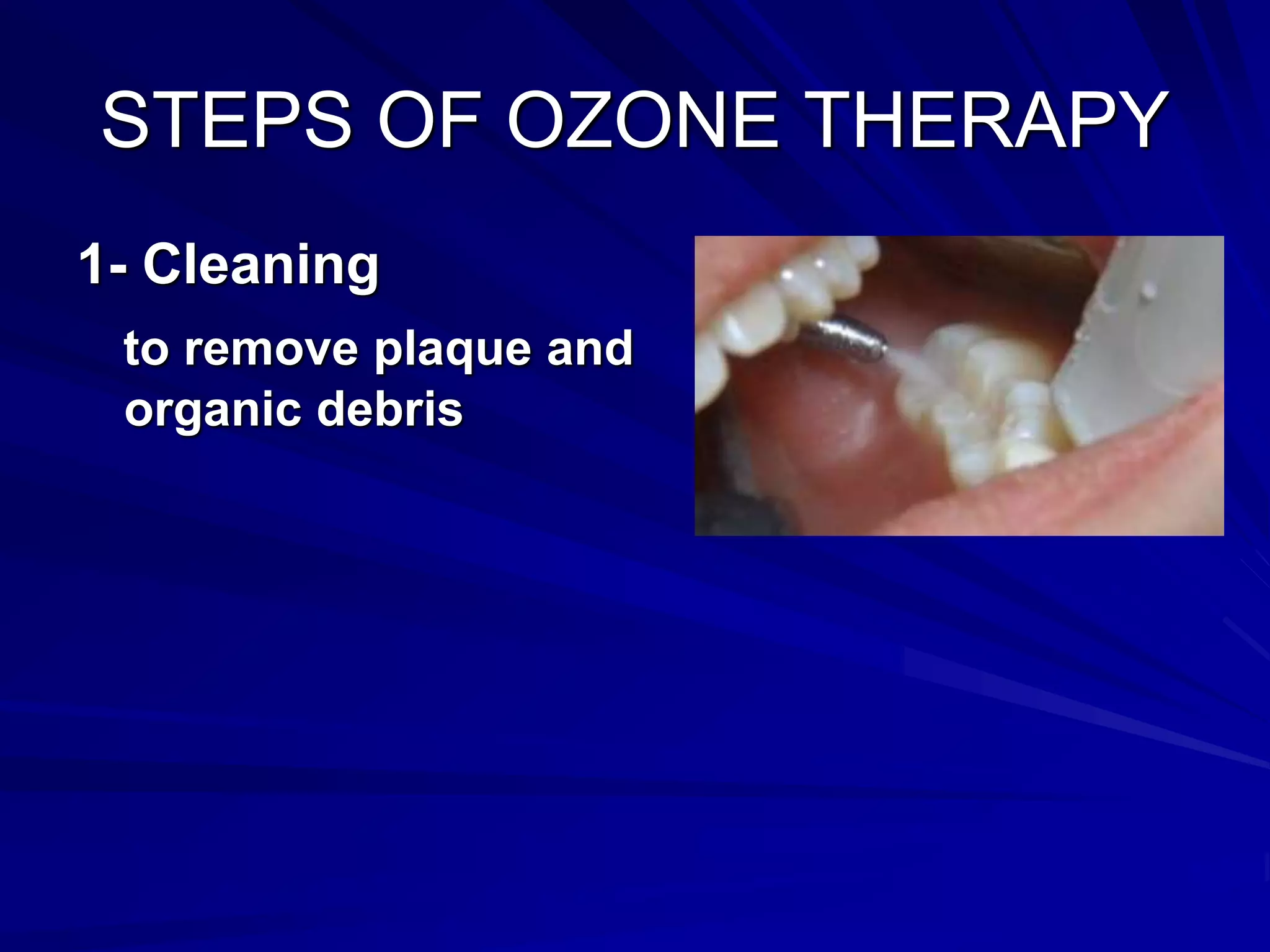 Minimally invasive caries therapy | PPT