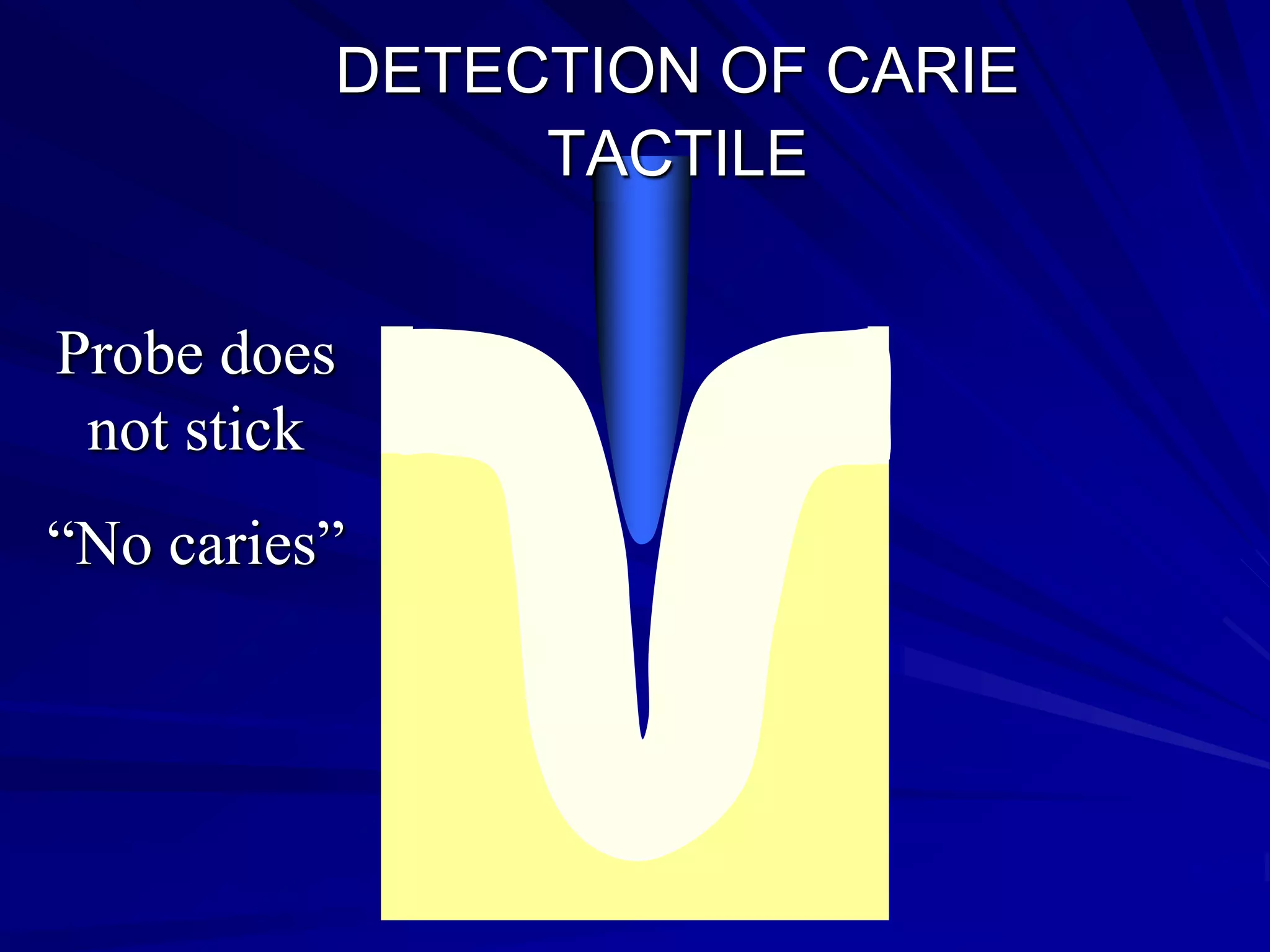 Minimally invasive caries therapy | PPT