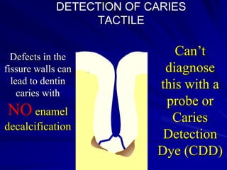 Minimally invasive caries therapy | PPT