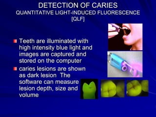 Minimally invasive caries therapy | PPT