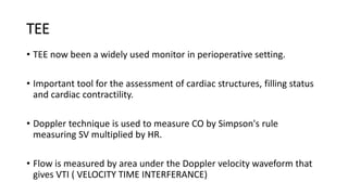 Minimally invasive Cardiac output Monitoring | PPTX