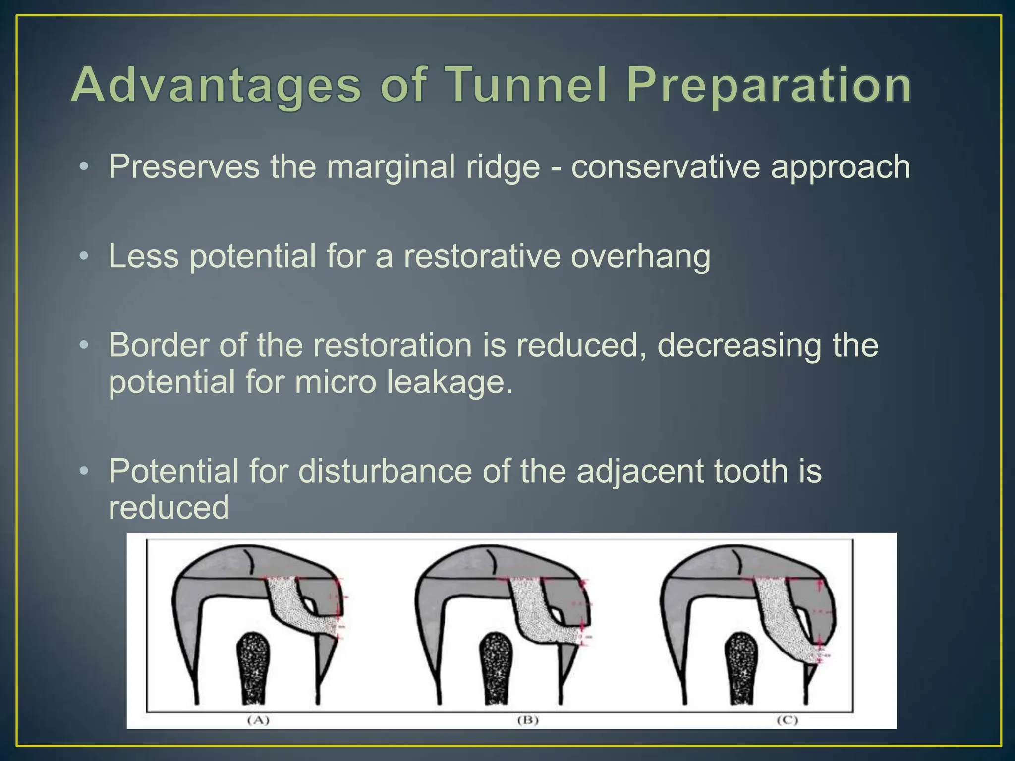 Minimally Invasive Dentistry part 1.ppt