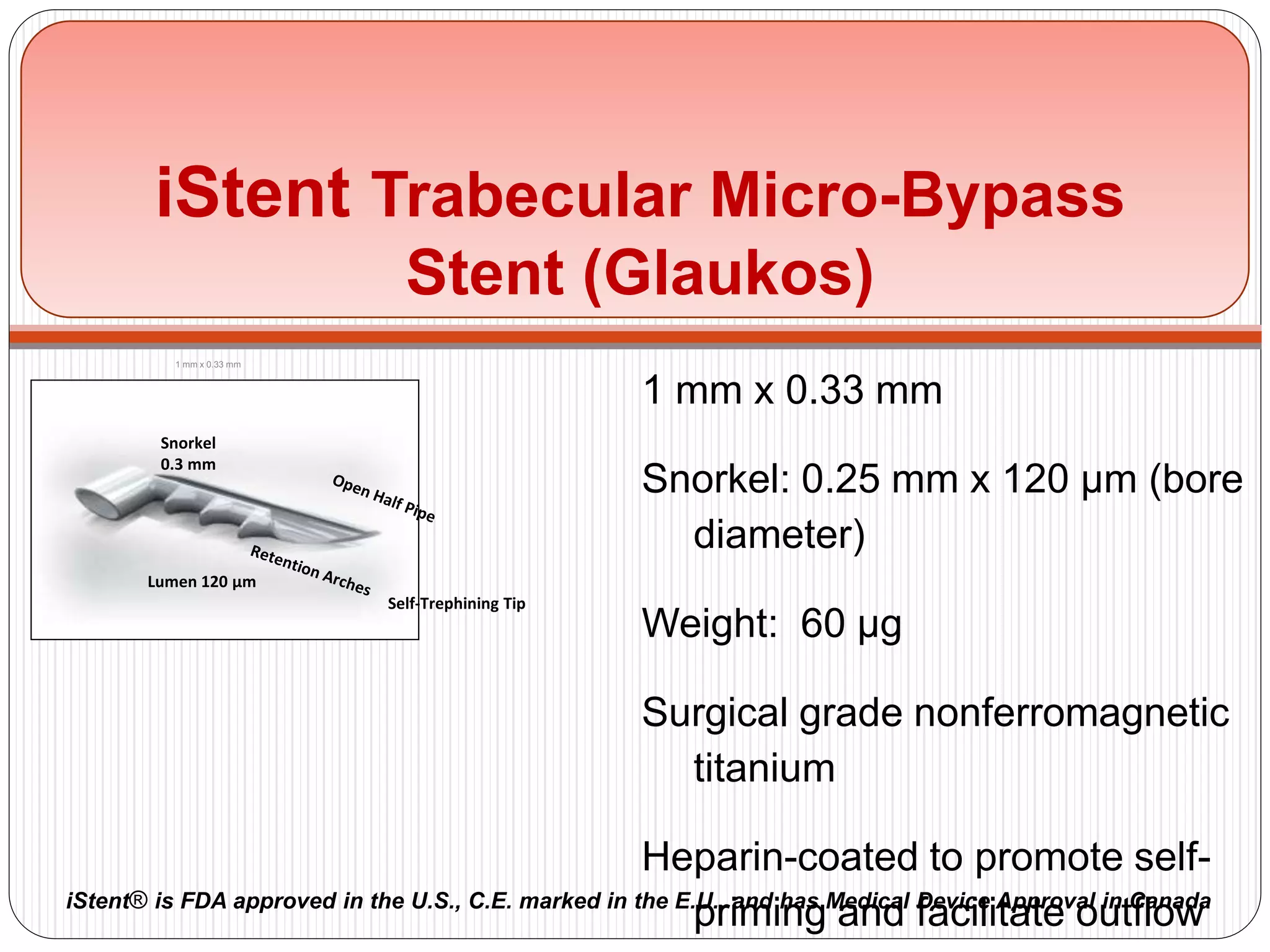 Minimally invasive glaucoma surgery | PPTX