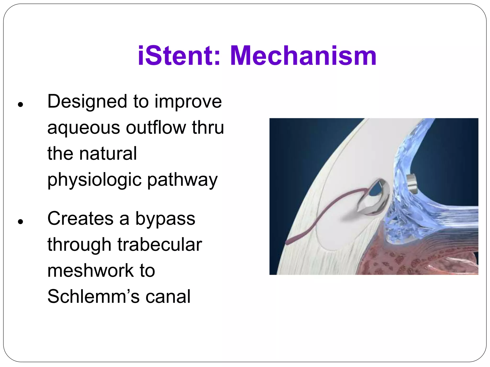 Minimally invasive glaucoma surgery | PPTX