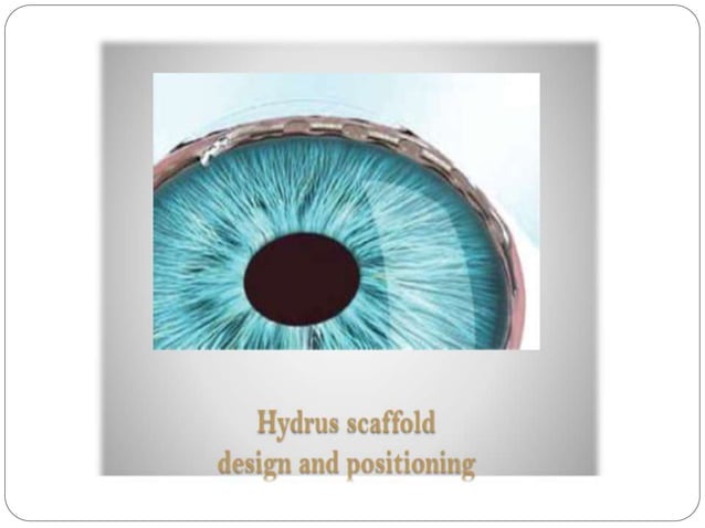 Minimally Invasive Glaucoma Surgery Pptx