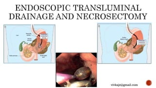 Minimally invasive necrosectomy | PPT