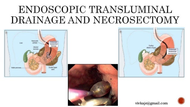 Minimally invasive necrosectomy