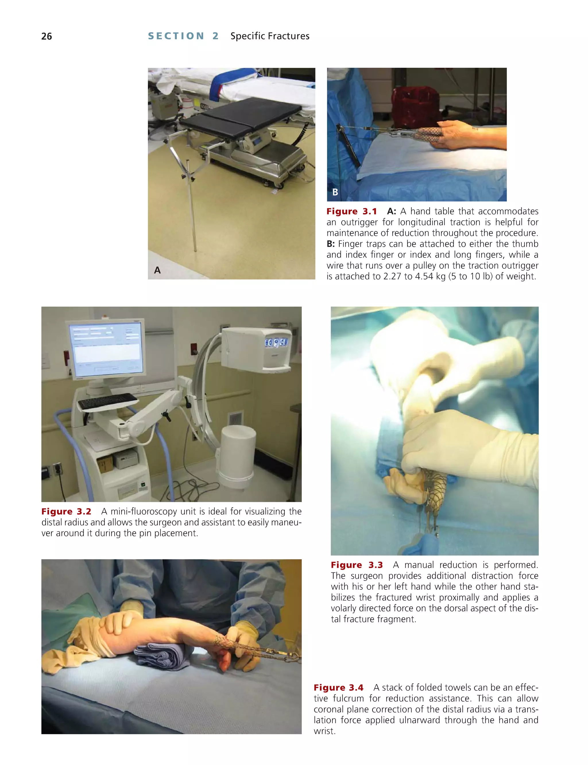 Minimally Invasive Orthopaedic Trauma.pdf