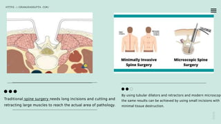 Minimally invasive spine surgery.pptx