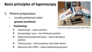 MINIMALLY INVASIVE SURGERY.pptx