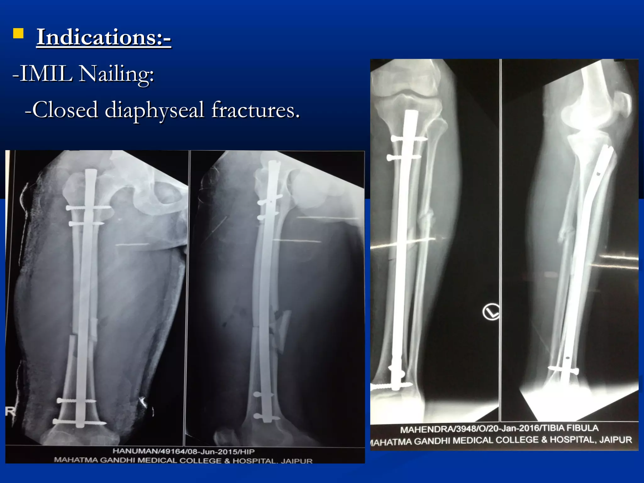 Minimally Invasive Surgery in Orthopaedics. | PPT