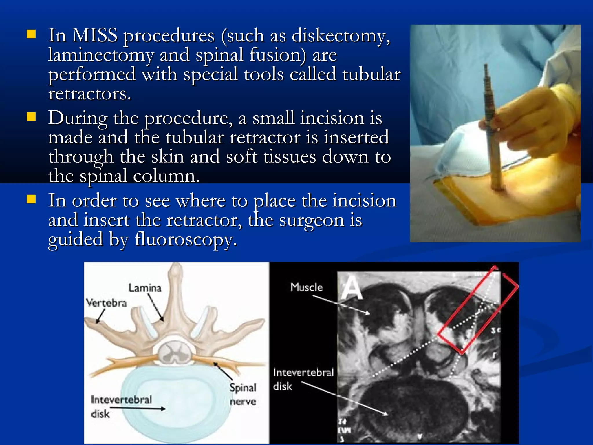 Minimally Invasive Surgery in Orthopaedics. | PPT