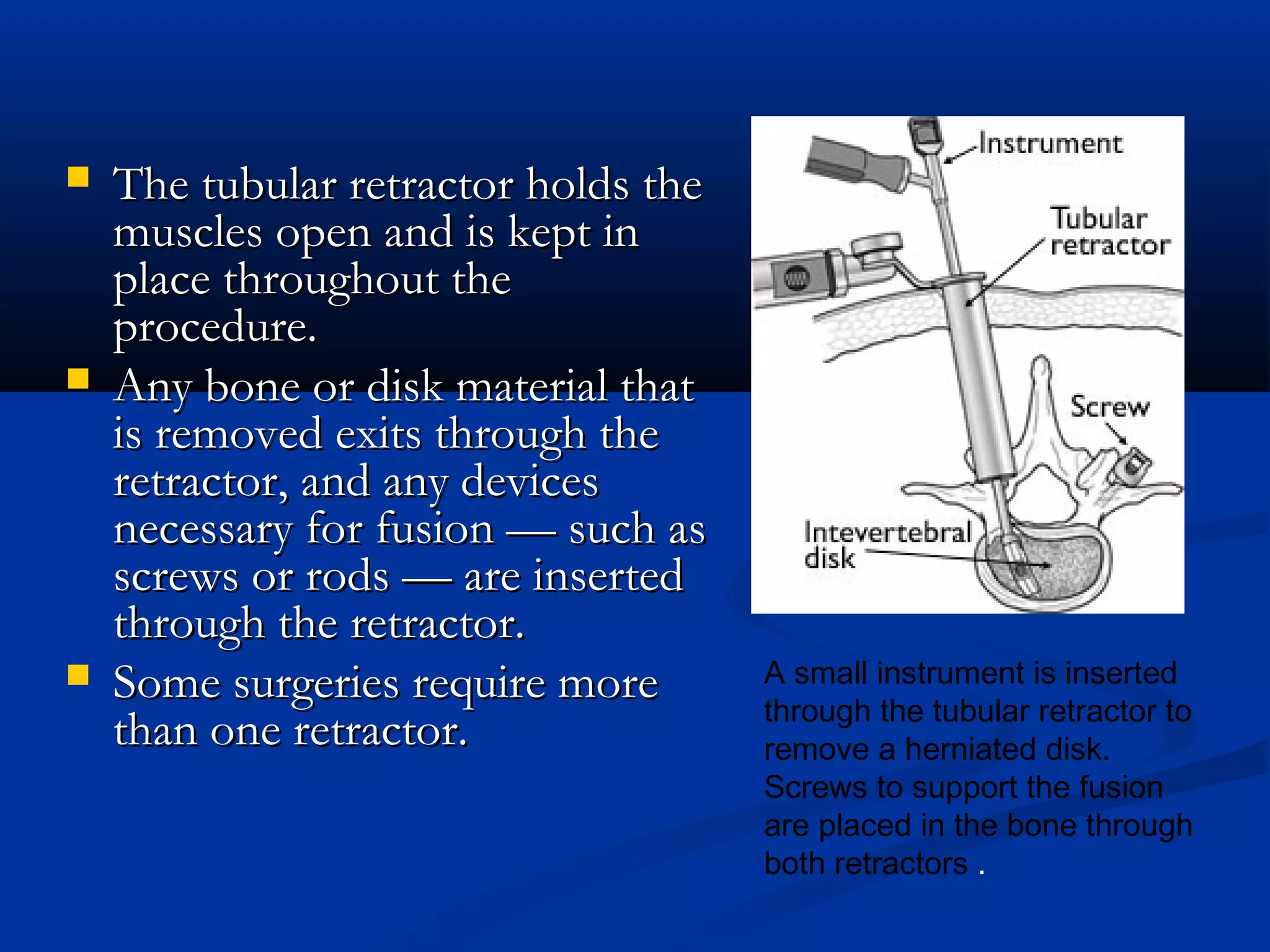 Minimally Invasive Surgery in Orthopaedics. | PPT