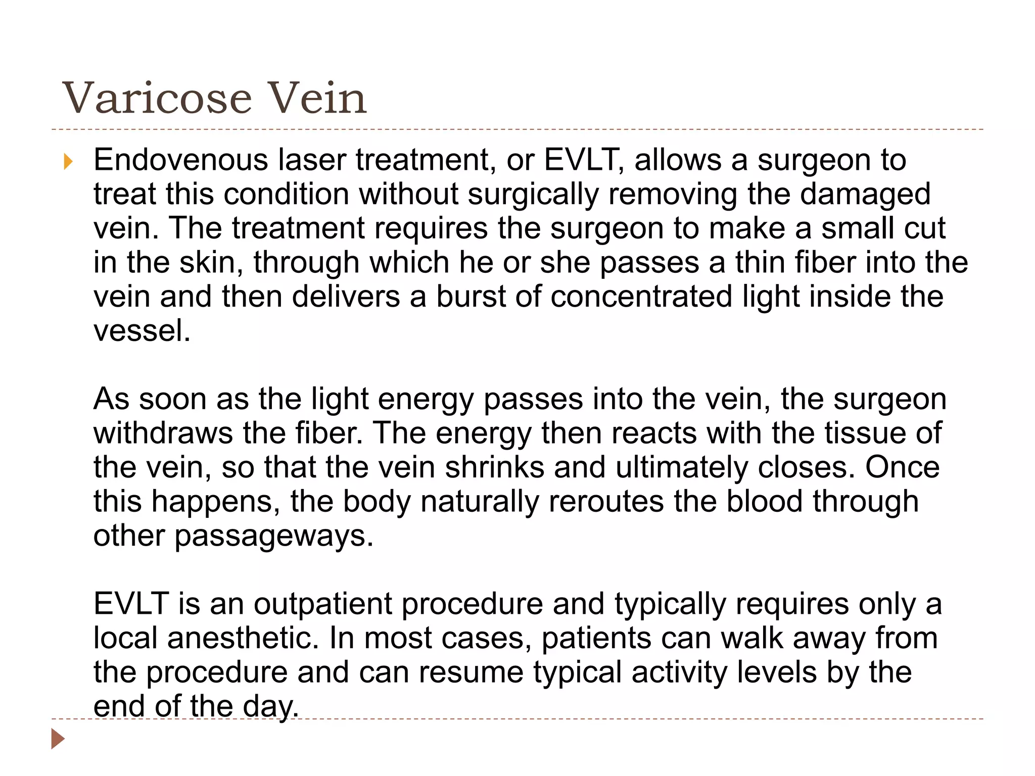 Minimally Invasive Varicose Vein Ablation | PPT
