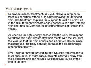 Minimally Invasive Varicose Vein Ablation | PPT