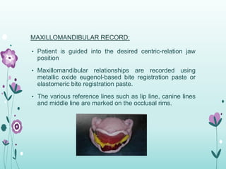 Minimal Visit Complete Denture | PPTX