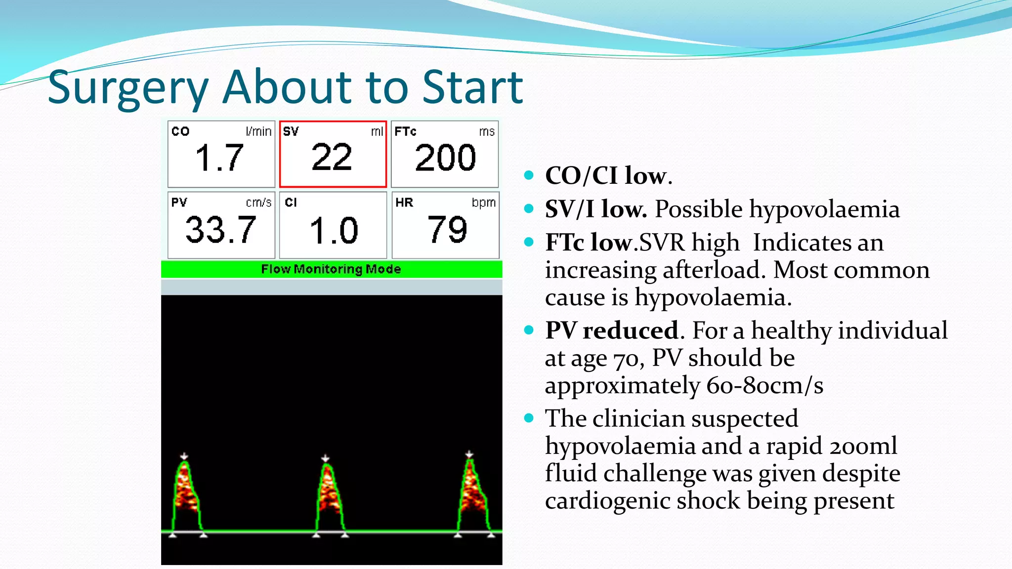 Minimaly invasive hemodynamic monitoring for hepatic patients | PDF