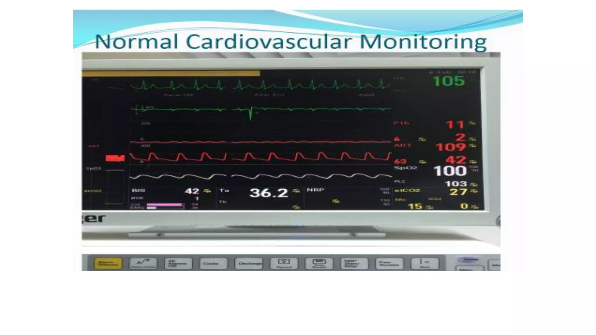 Minimaly invasive hemodynamic monitoring for hepatic patients | PDF