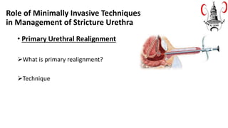 Minimaly invasive tchniques | PPT