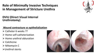 Minimaly invasive tchniques | PPT