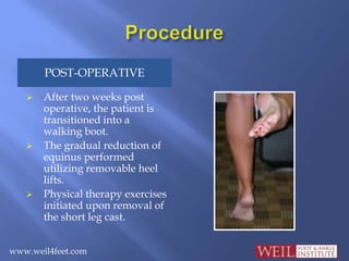 Retrospective analysis on mini-open technique for Achilles tendon ...