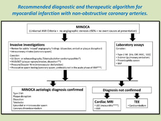 MINOCA , Myocardial Infarction with Non-Obstructive Coronary Arteries ...