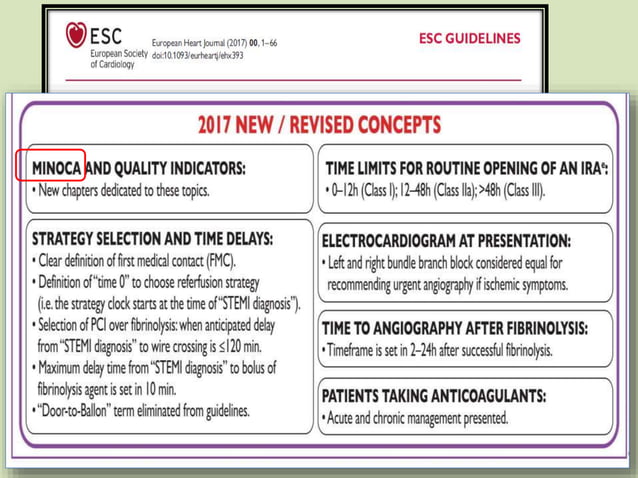 MINOCA , Myocardial Infarction with Non-Obstructive Coronary Arteries ...