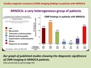 MINOCA , Myocardial Infarction with Non-Obstructive Coronary Arteries ...