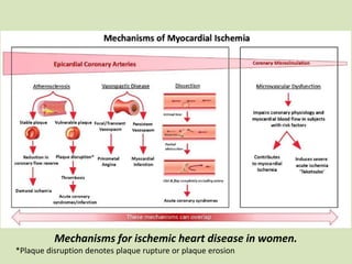 MINOCA , Myocardial Infarction with Non-Obstructive Coronary Arteries ...