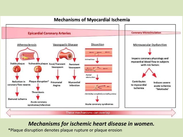 MINOCA , Myocardial Infarction with Non-Obstructive Coronary Arteries ...