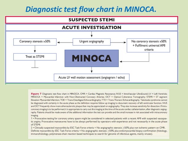 MINOCA , Myocardial Infarction with Non-Obstructive Coronary Arteries