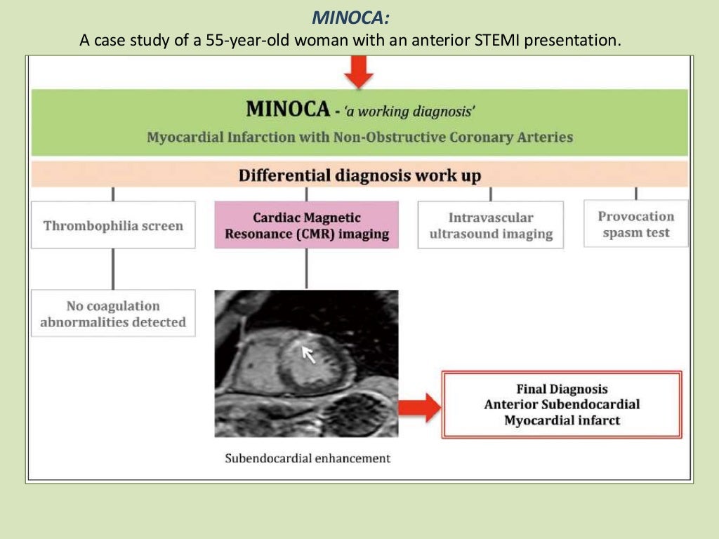 MINOCA , Myocardial Infarction with Non-Obstructive Coronary Arteri…