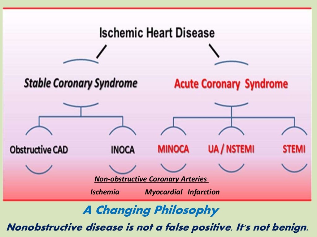MINOCA , Myocardial Infarction with Non-Obstructive Coronary Arteri…