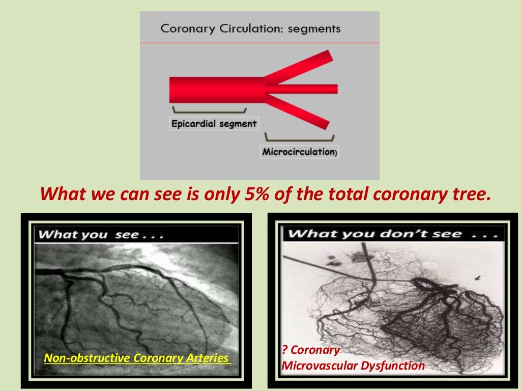 MINOCA , Myocardial Infarction with Non-Obstructive Coronary Arteri…