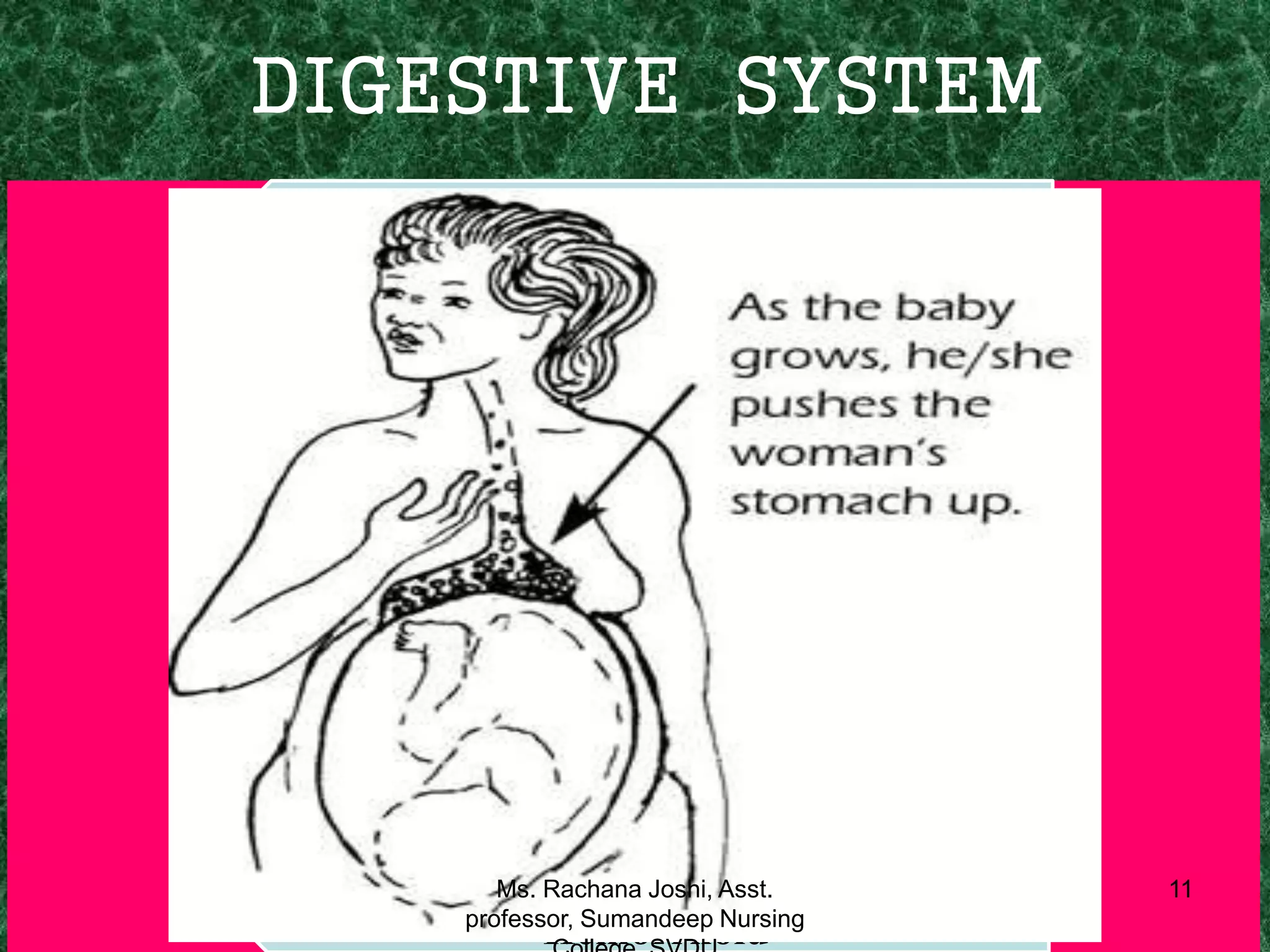 Minor ailments of Pregnancy | PPTX