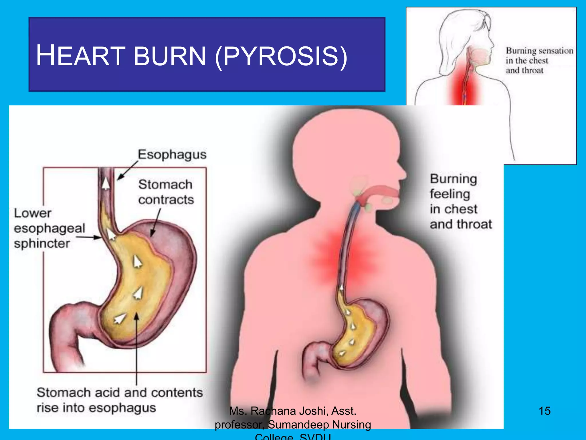 Minor ailments of Pregnancy | PPTX