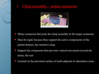 MINOR CONNECTOR-part of cast partial denture | PPTX