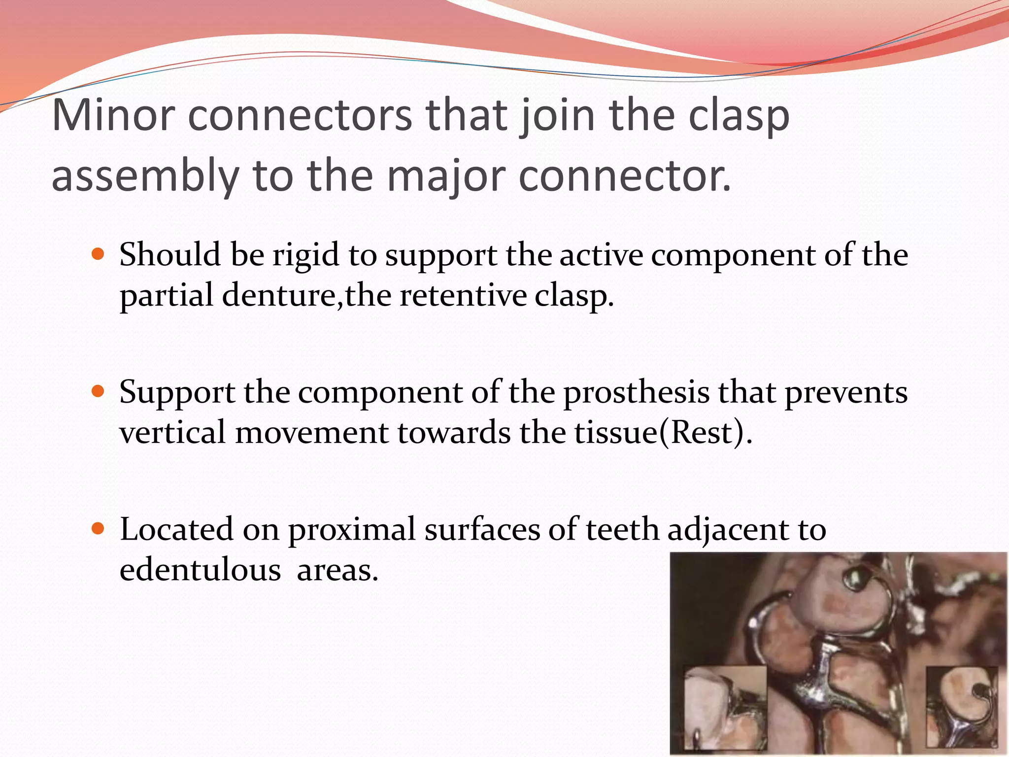 Minor connectors | PPTX