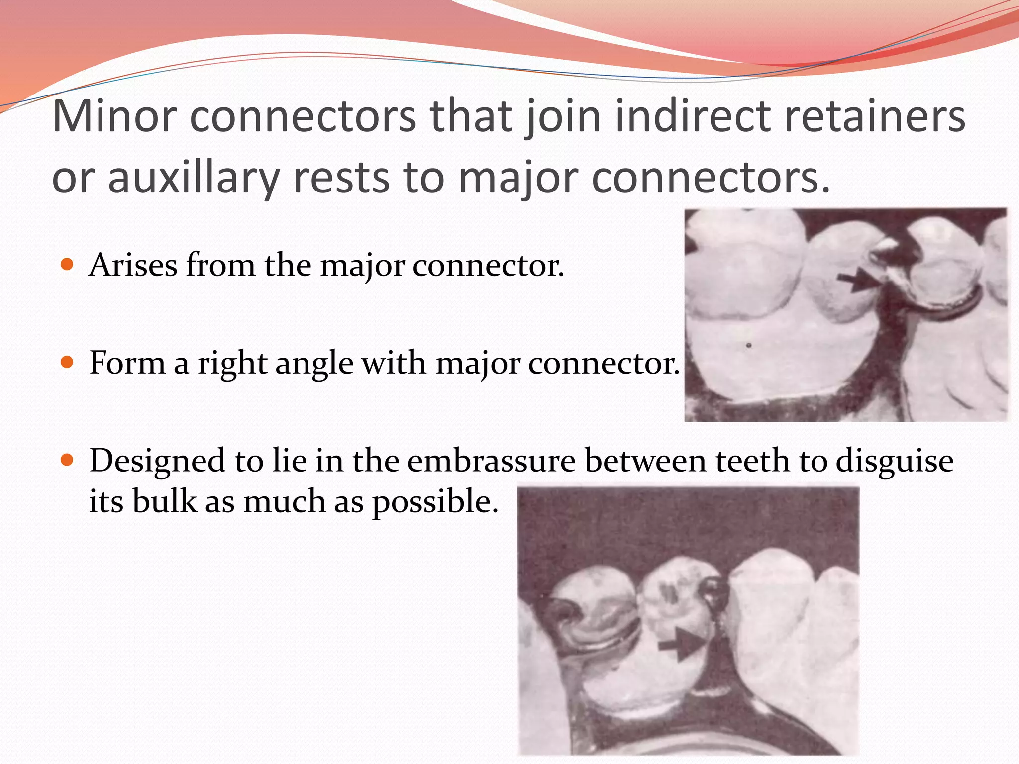 Minor connectors | PPTX