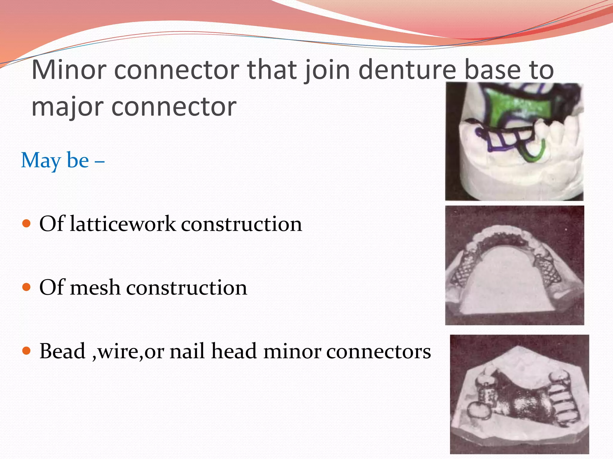 Minor connectors | PPTX