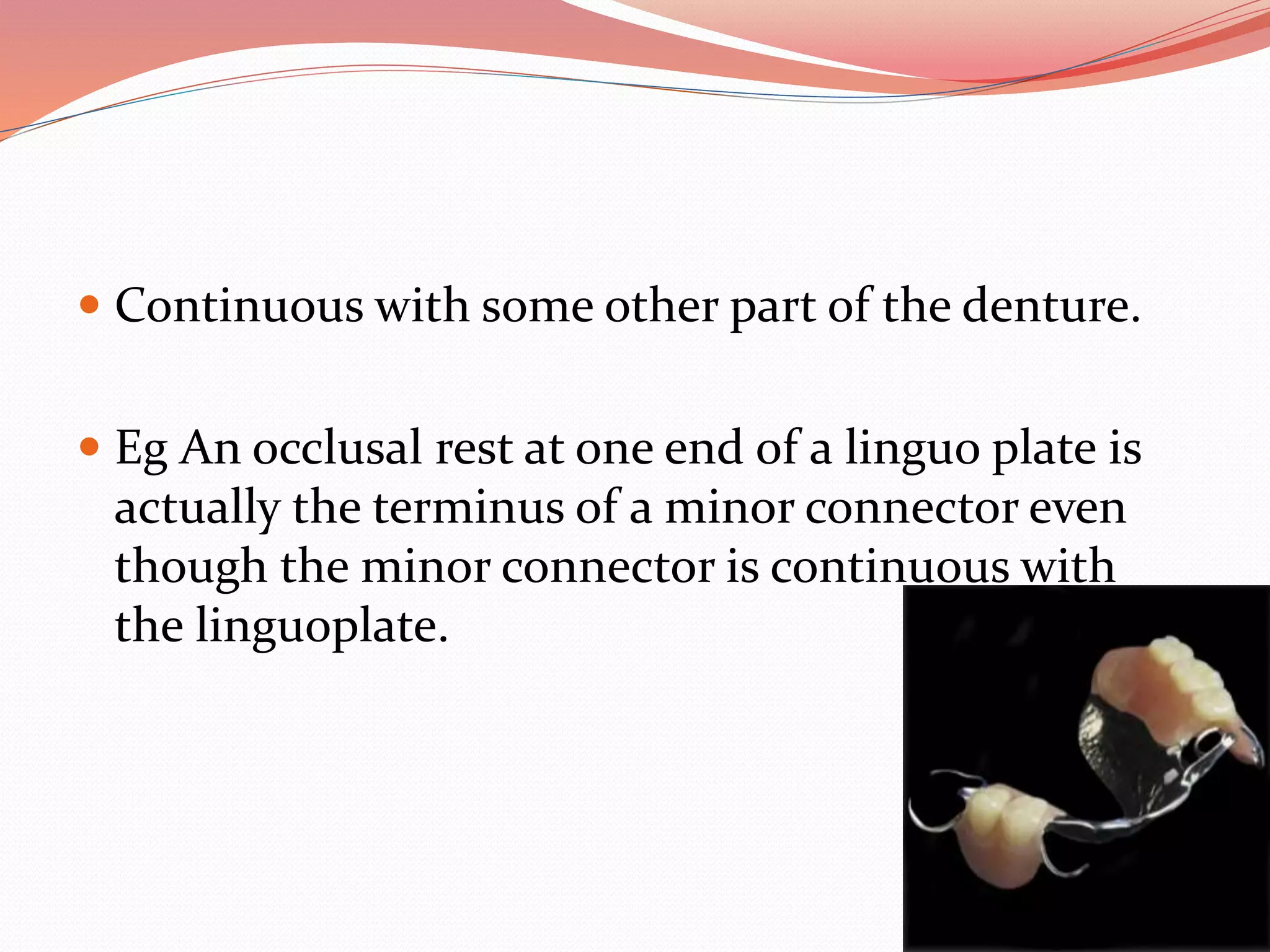 Minor connectors | PPTX