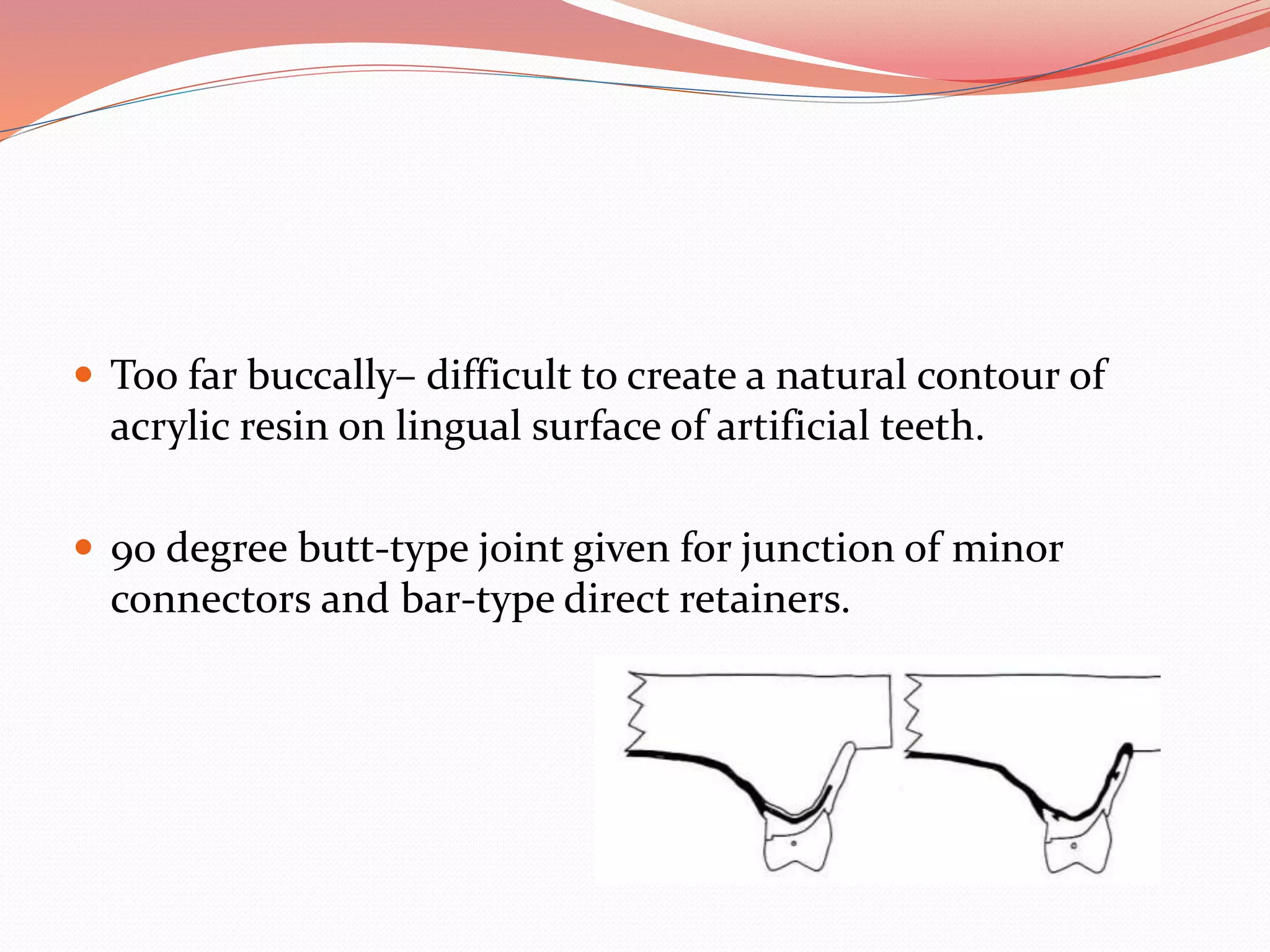 Minor connectors | PPTX