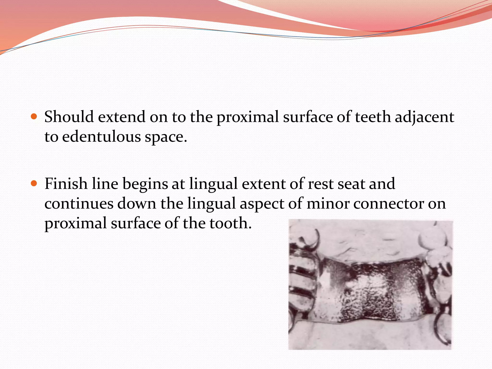Minor connectors | PPTX