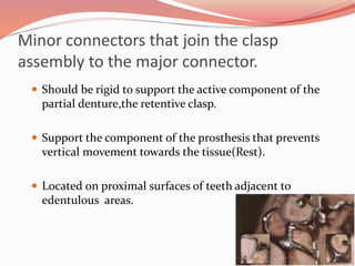 Minor connectors | PPTX