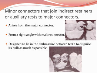 Minor connectors | PPTX