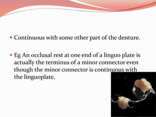 Minor connectors | PPTX