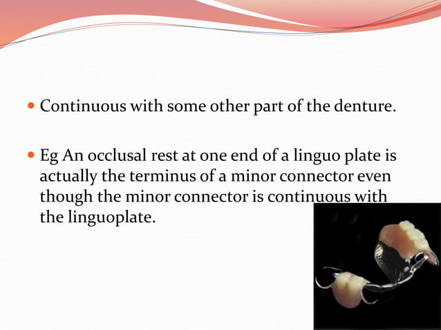 Minor connectors | PPTX | Dental Health | Diseases and Conditions