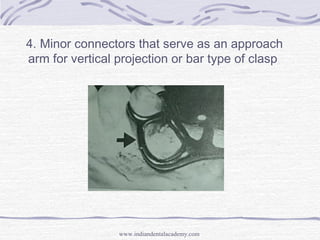 Minor connectors /certified fixed orthodontic courses by Indian dental ...
