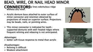 Minor connectors | PPTX