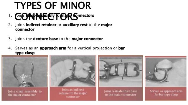 Minor connectors